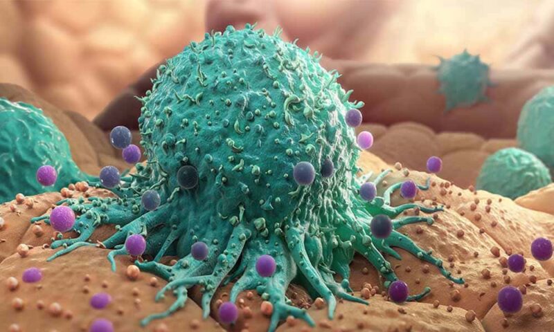 Jenis-jenis Kanker serta Penjelasan yang Komprehensif - Inti Lampung